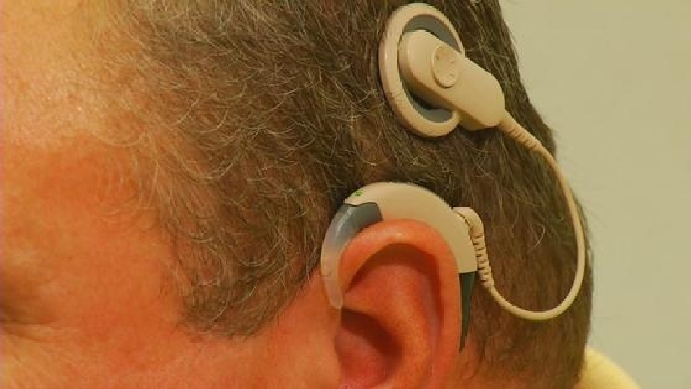 Health Alert: Mission's First Cochlear Implant | WLOS