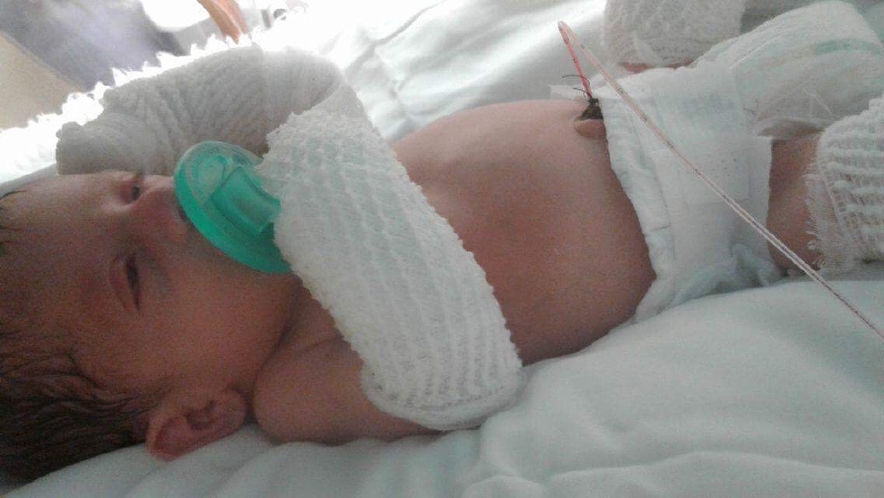 Meet Elijah, another CNY child born with extremely rare skin disease ...